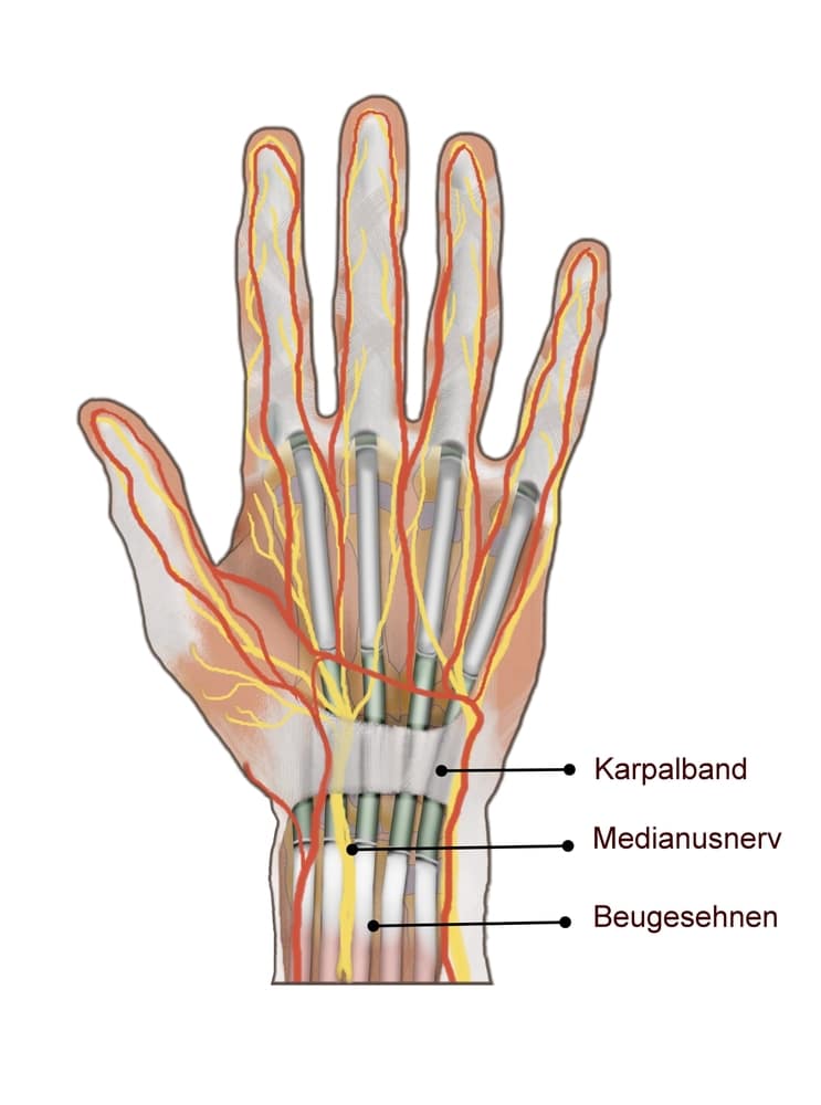 Carpal Tunnel | Carpal Tunnel Surgery Clinic Carpal Tunnel | Carpal Tunnel Surgery Clinic