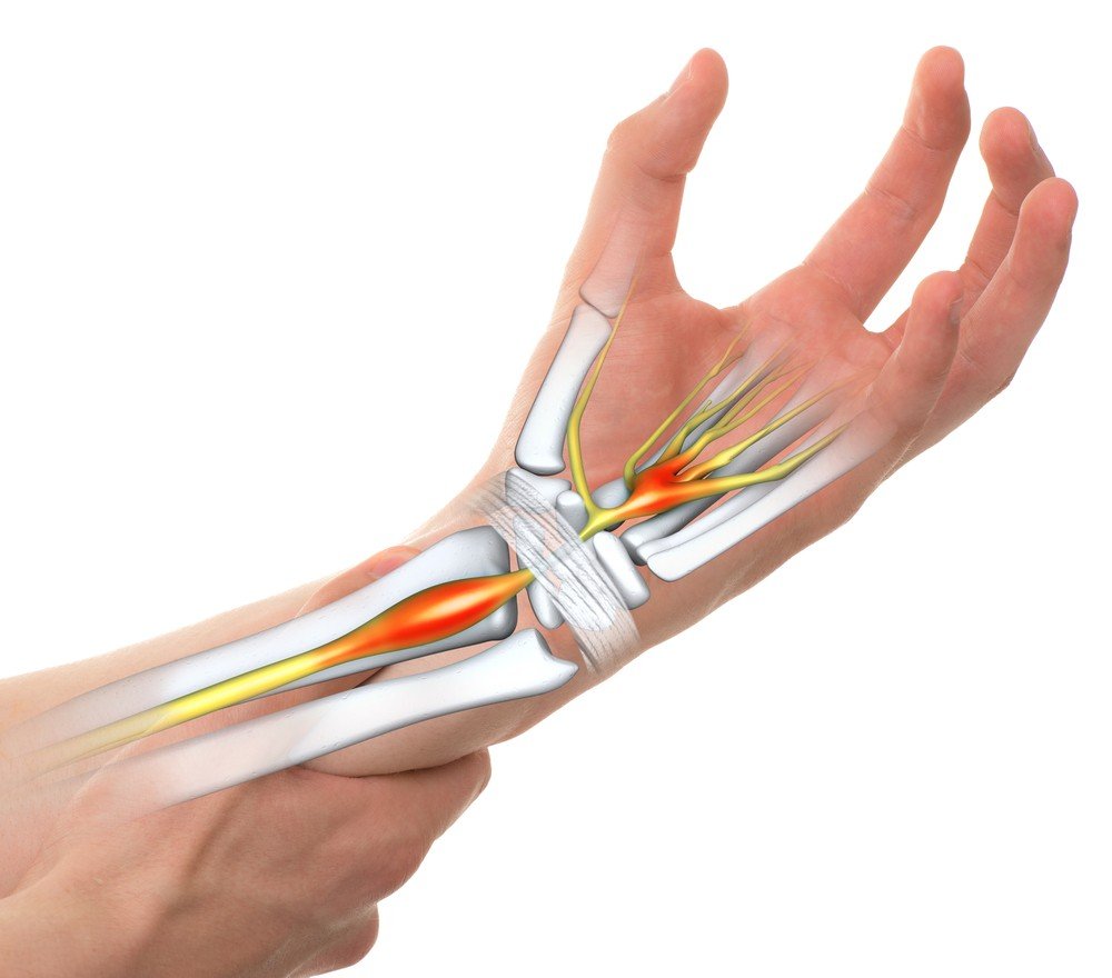 Risks Of Carpal Tunnel Release Surgery Carpal Tunnel Surgery Clinic Risks Of Carpal Tunnel Release Surgery Carpal Tunnel Surgery Clinic